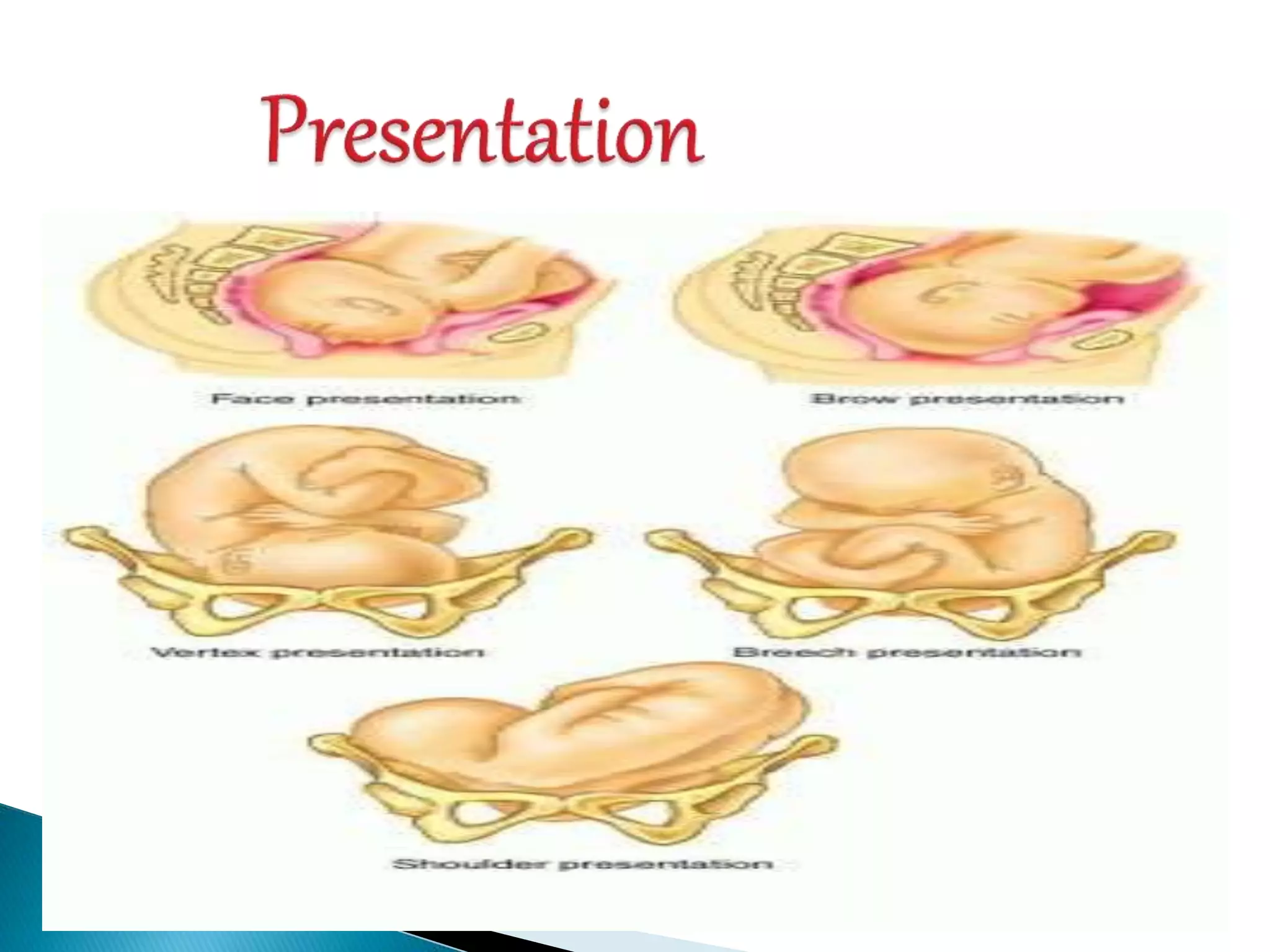 Fetus in utero | PPTX