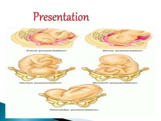 Fetus in utero | PPTX