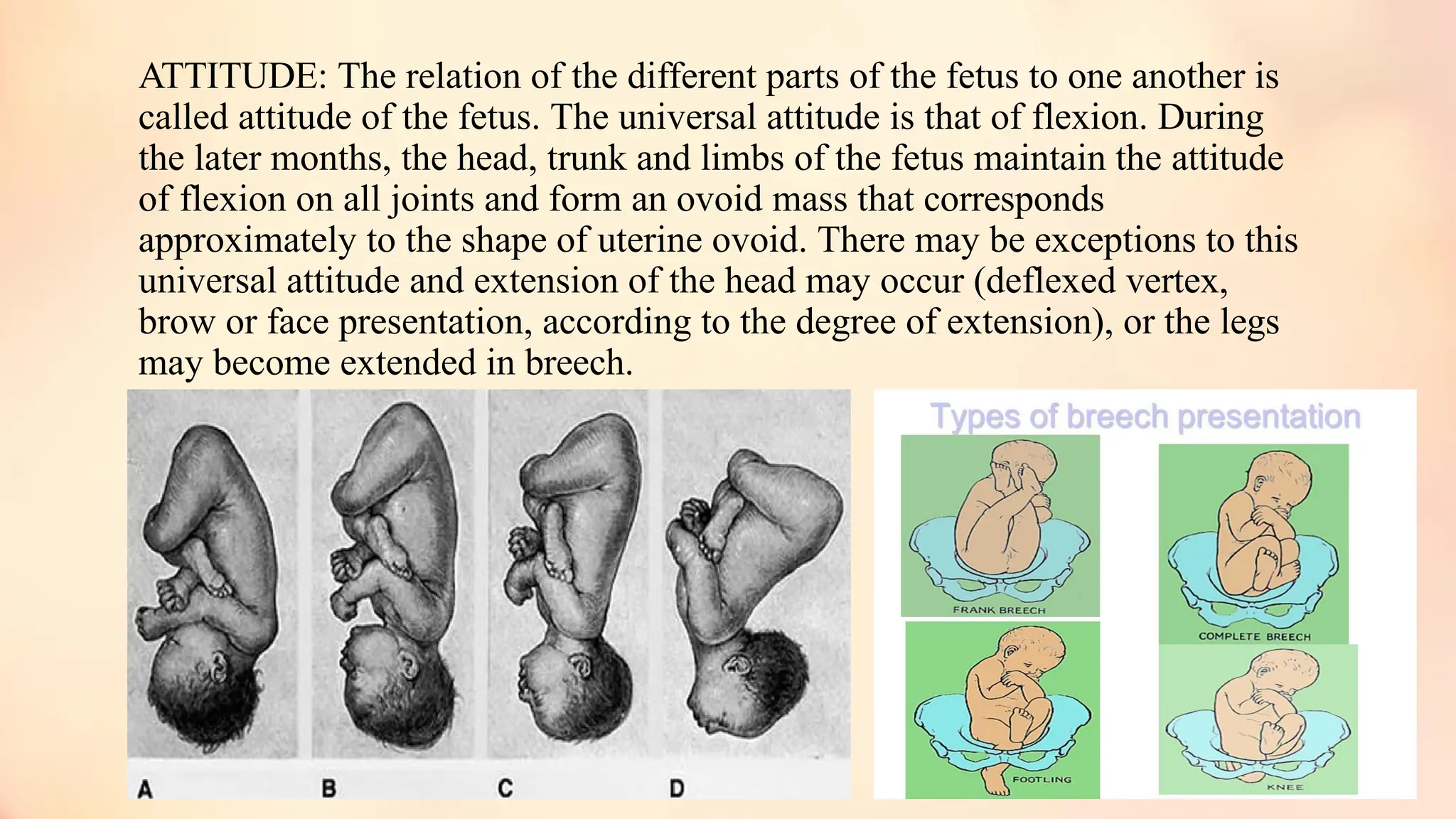 fetus in uterus, postion , presentation of fetus in mother's womb | PPTX