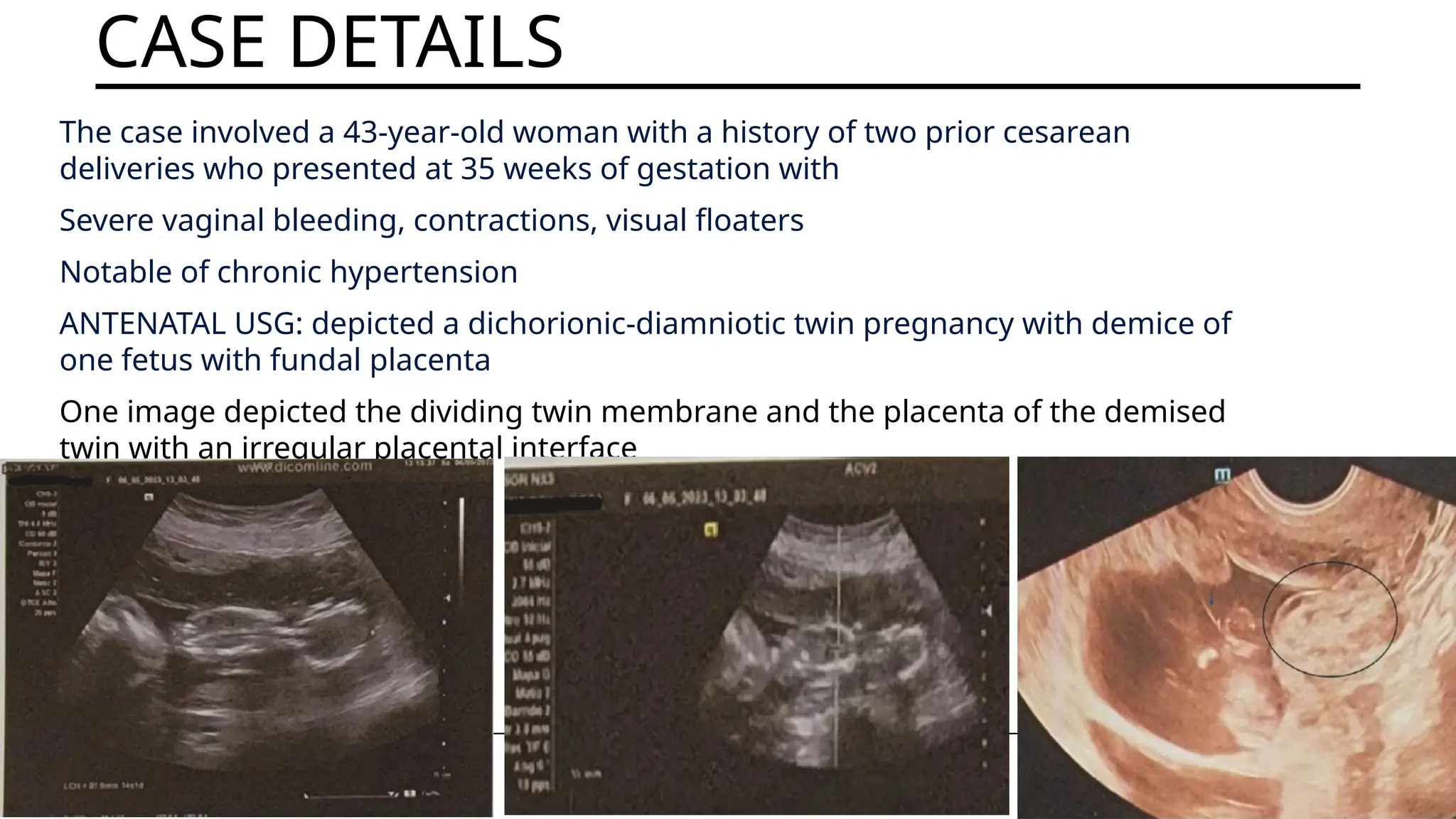 Sudden loss of fetal heart tones, shock, and collapse if rupture is ...