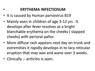 Fever and rash | PPTX