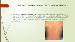 Approach to a patient with Fever And Rash.pptx