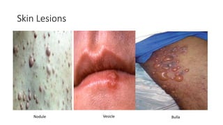 fever and rashes.pptx