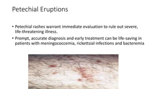 fever and rashes.pptx | Skin and Dermatology | Diseases and Conditions