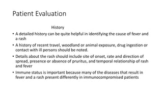 fever and rashes.pptx