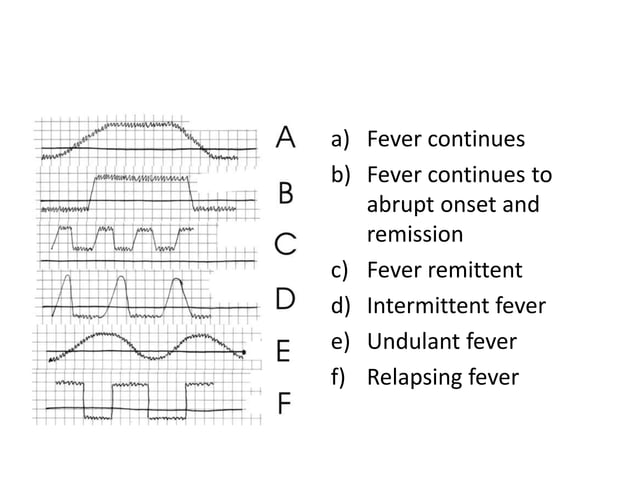 Fever in children | PPTX