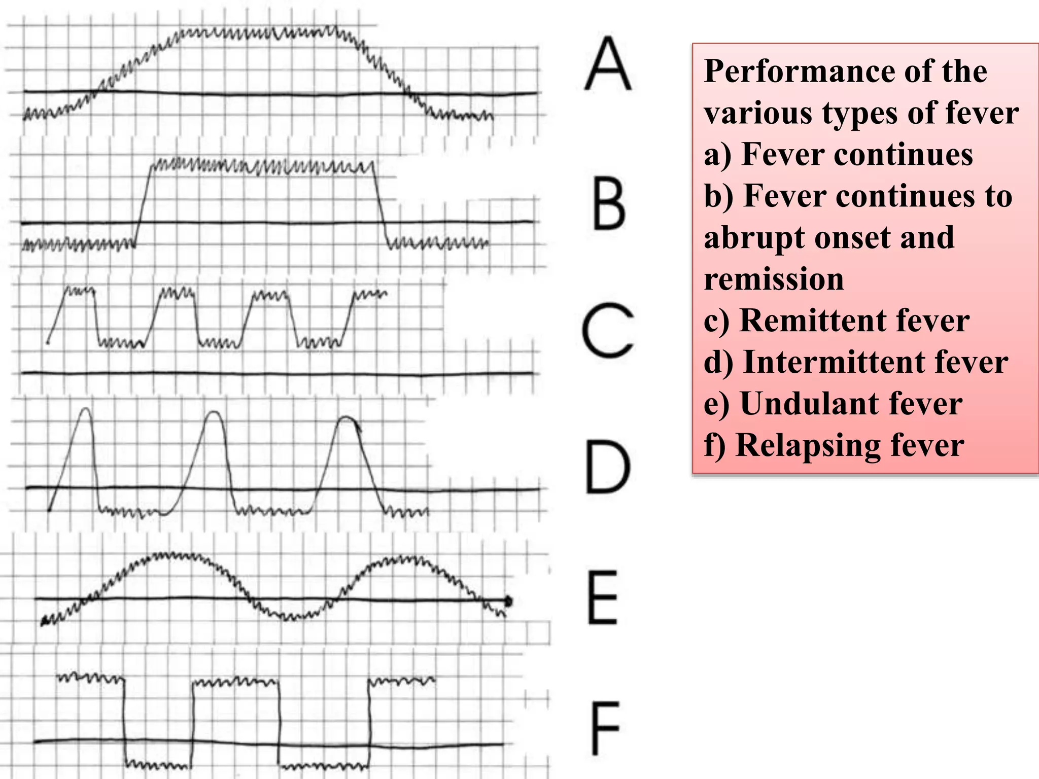 Fever of unknown origin | PPTX