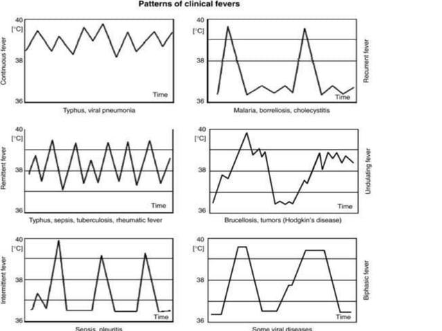 Fever of unknown origin | PPTX | Infectious Diseases | Diseases and ...