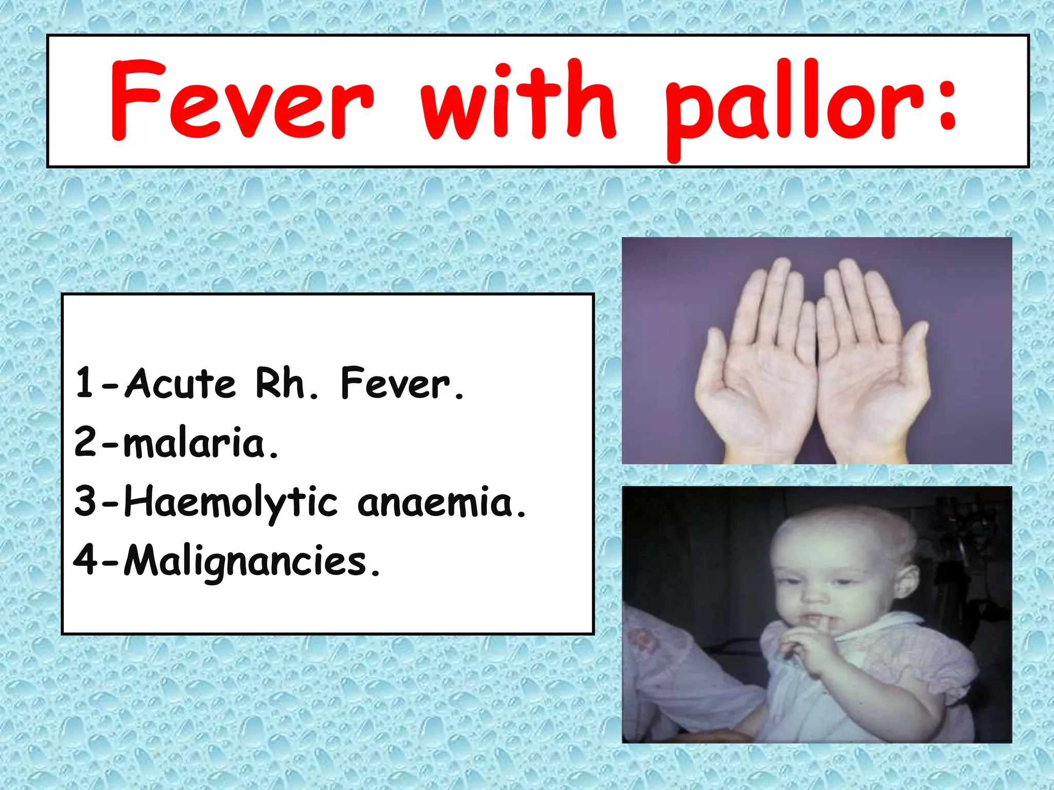 for beginner 2024 new update Fever presentation | PPTX | Infectious ...