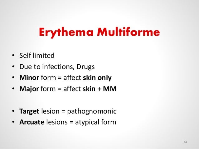 Erythema Multiforme Major Vs Minor
