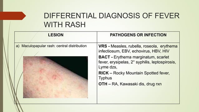 Fever & Rash | PPTX