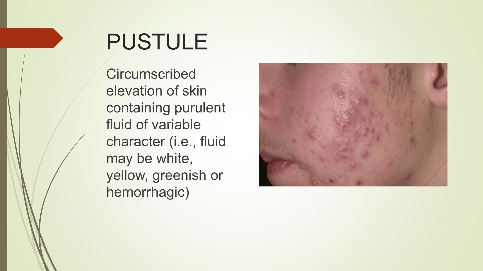 Fever & Rash | PPTX