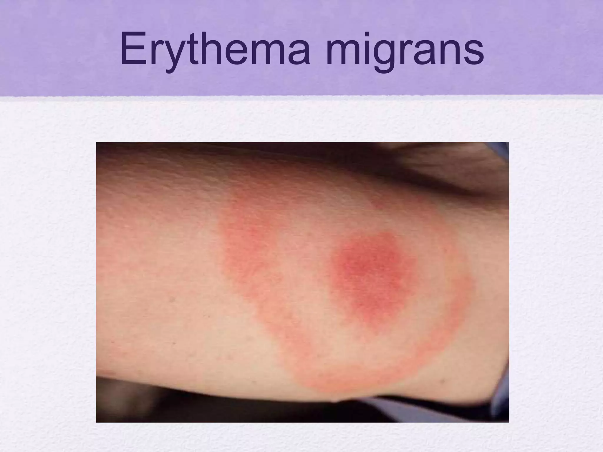 Demystifying Fever & Rash in Children | PPTX