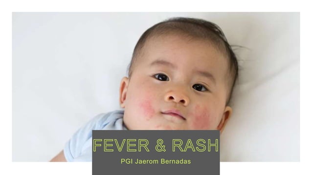 Pediatrics: FEVER and RASH (Nelson Textbook of Pediatrics 21st Edition ...
