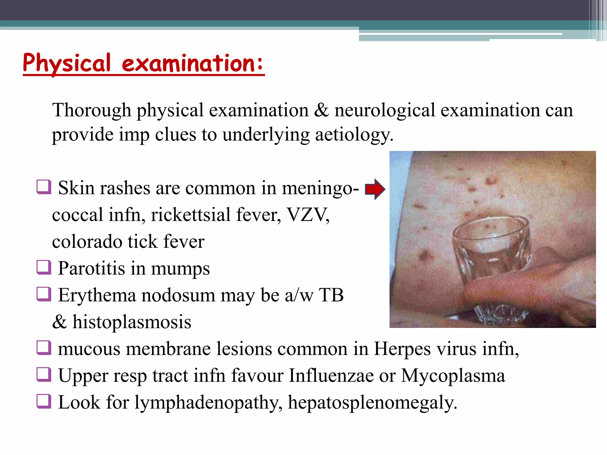 Approach to a case of Fever with altered sensorium | PPTX