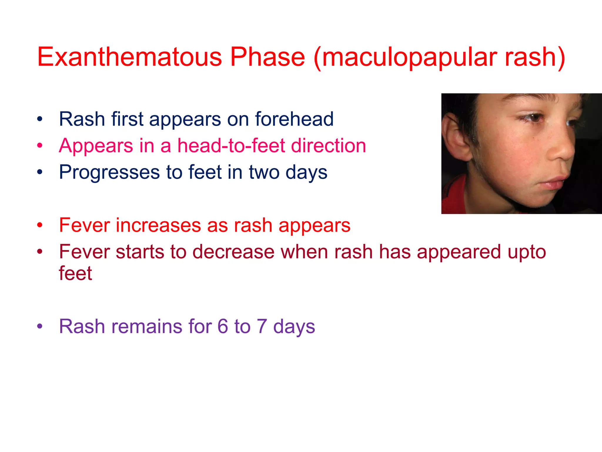 Fever with a maculopapular skin rash in children 2021 | PDF