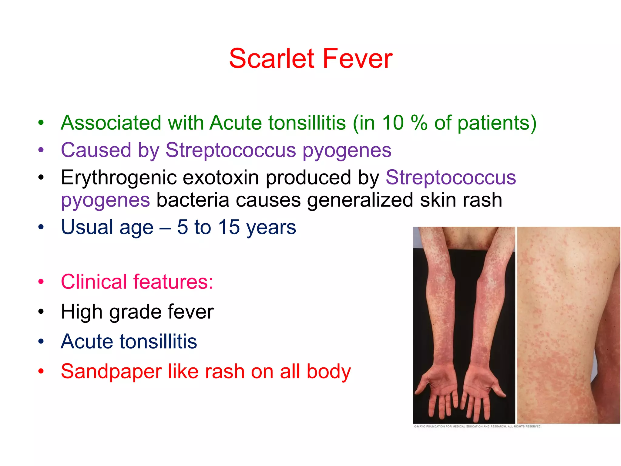Fever with a maculopapular skin rash in children 2021 | PDF