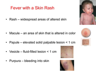 Fever with a maculopapular skin rash in children 2021 | PPT