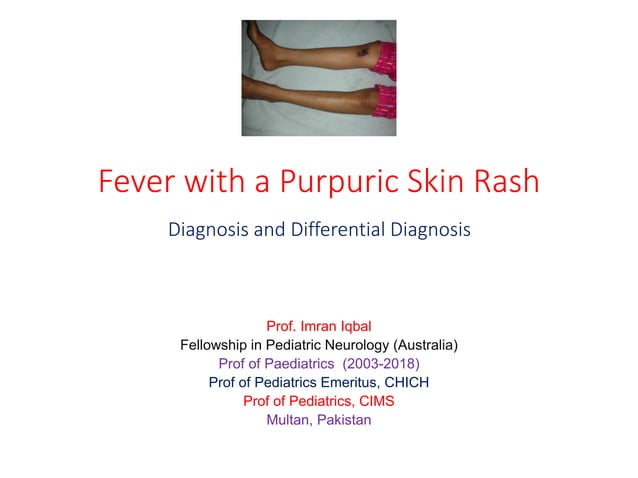 Fever with a purpuric skin rash in children 2021 | PPT