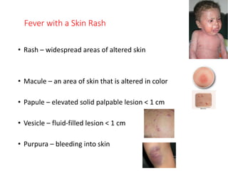 Fever with a purpuric skin rash in children 2021 | PDF