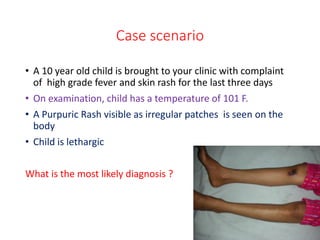 Fever with a purpuric skin rash in children 2021 | PDF