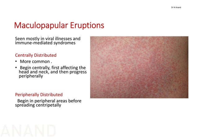 Fever with Rash | PDF