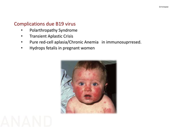 Fever with Rash | PDF