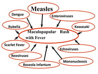 Fever with rash | PPT