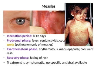 Fever with rash - Diagnosis and Treatment | PPTX