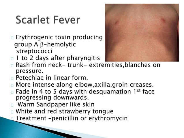 Fever with rashes