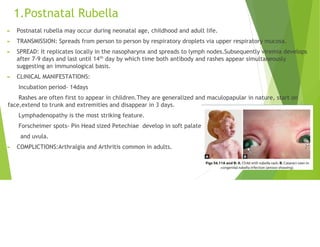 Fever with rashes, decribing various types of fever presenting with ...