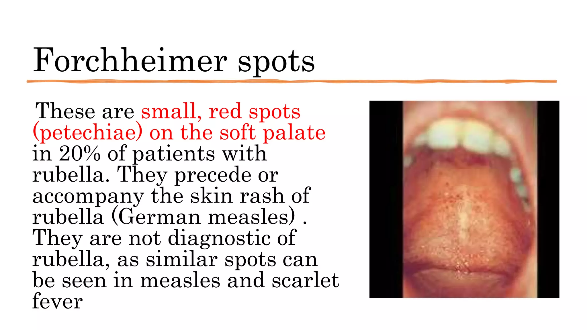 Fever with rash in children | PPTX
