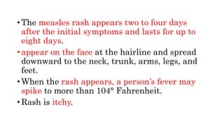 Fever with rash in children | PPTX