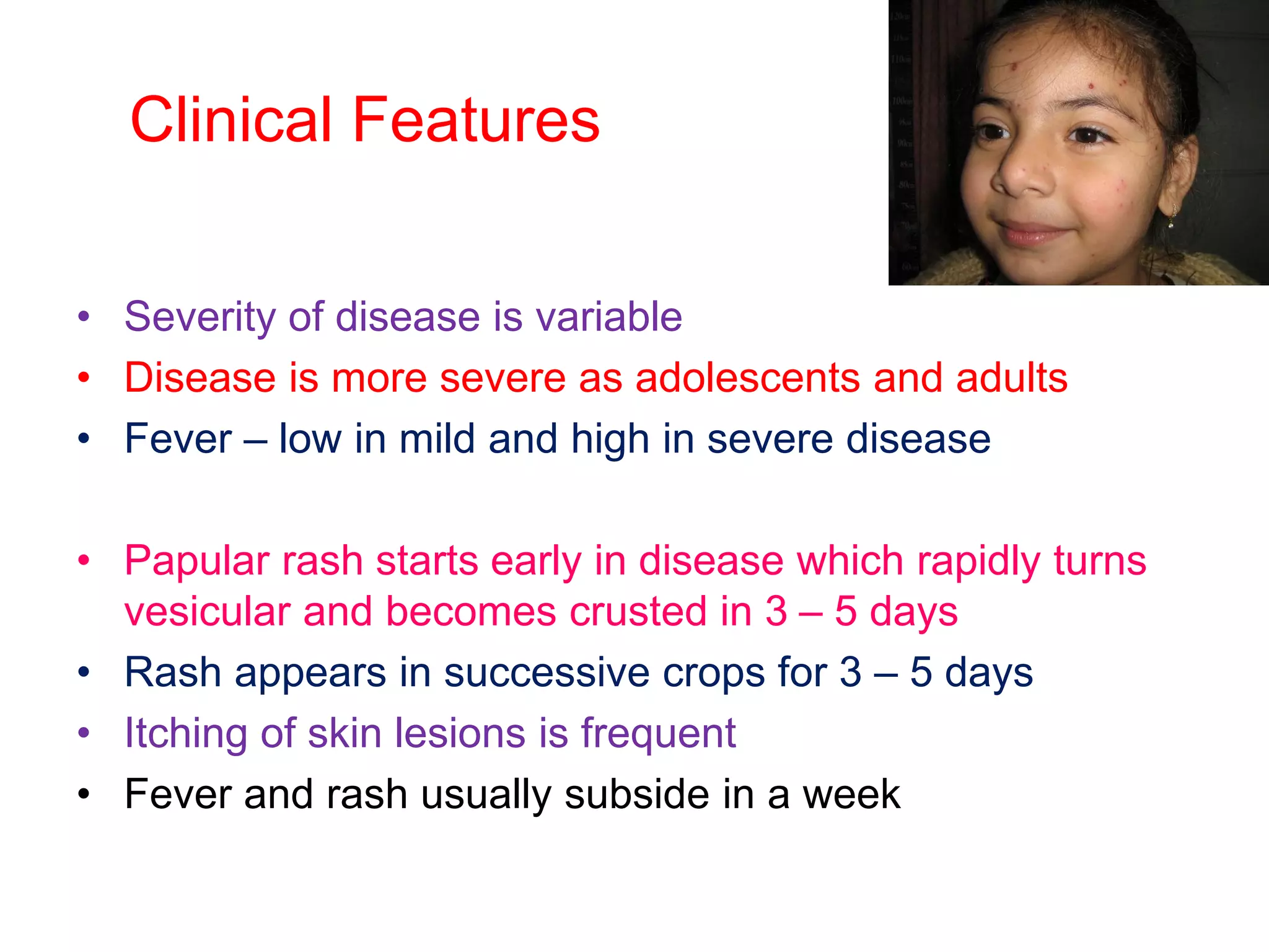 Fever with vesicular skin rash in children 2021 | PDF