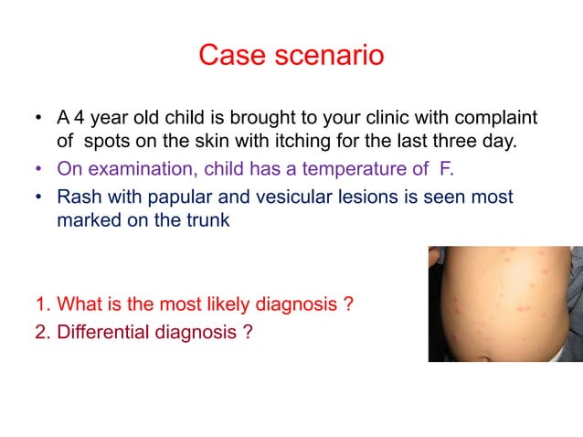 Fever with vesicular skin rash in children 2021 | PDF | Infectious ...