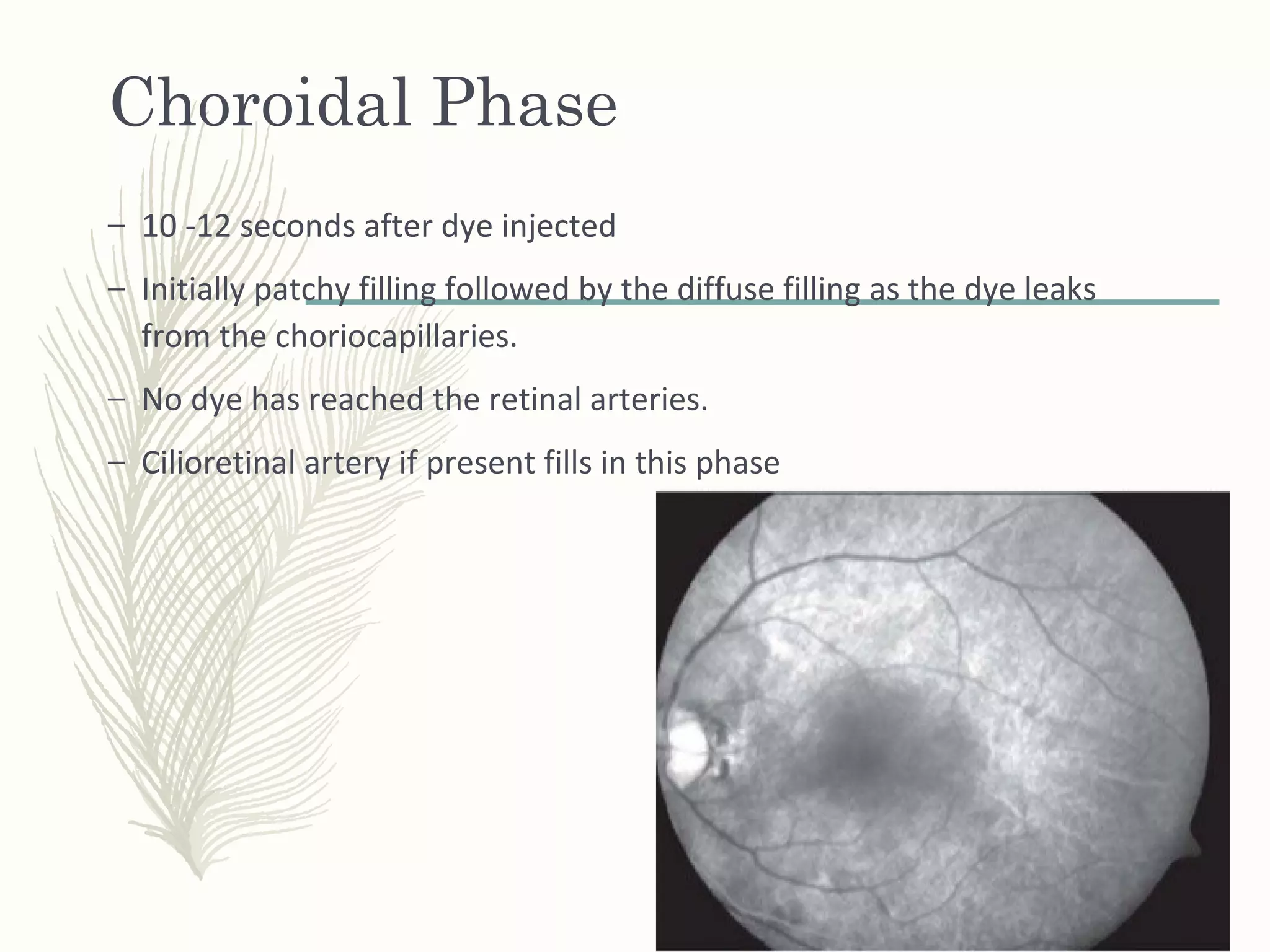 FUNDUS FLUORESCEIN ANGIOGRAPHY | PPT