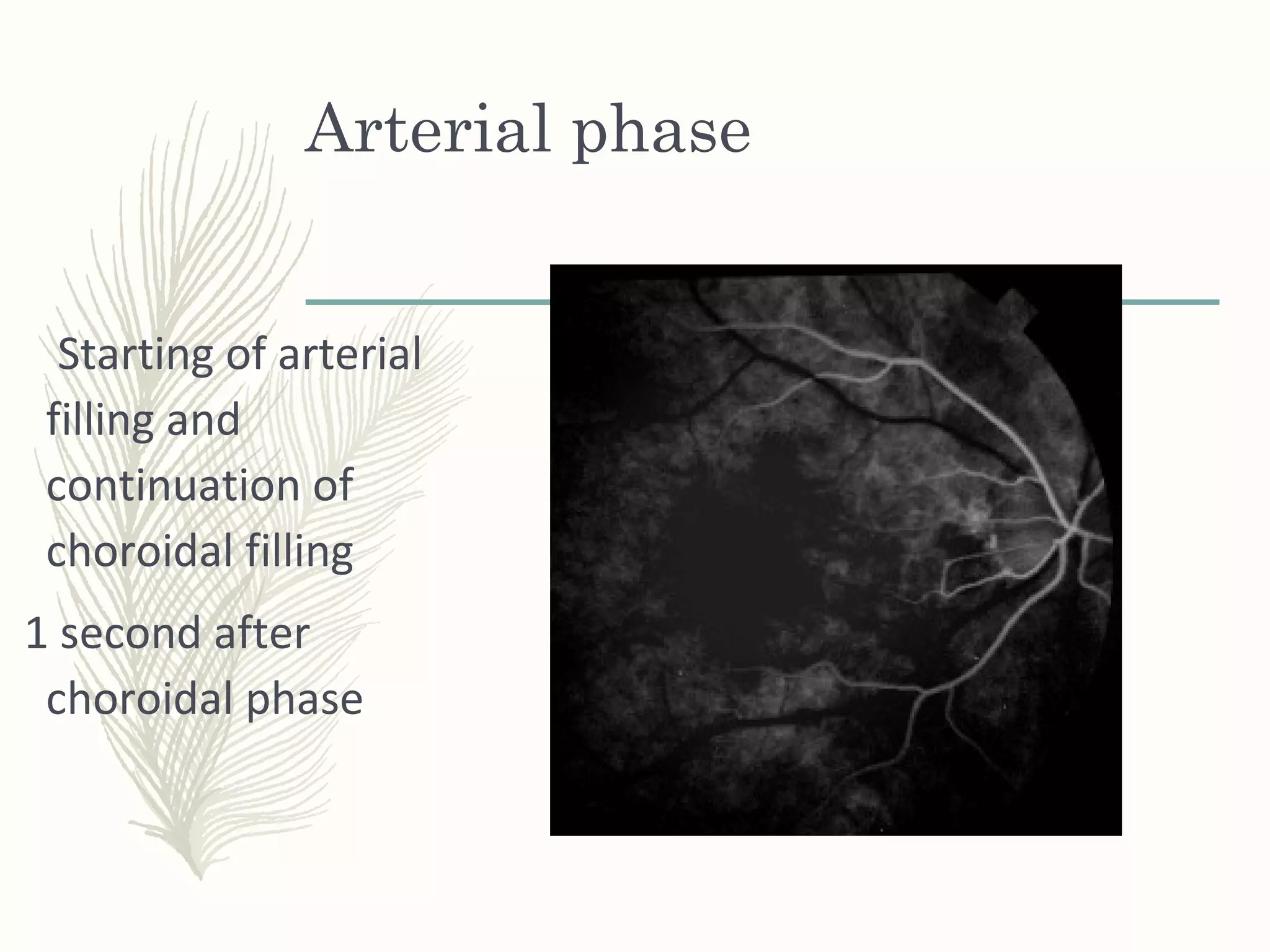 FUNDUS FLUORESCEIN ANGIOGRAPHY | PPT