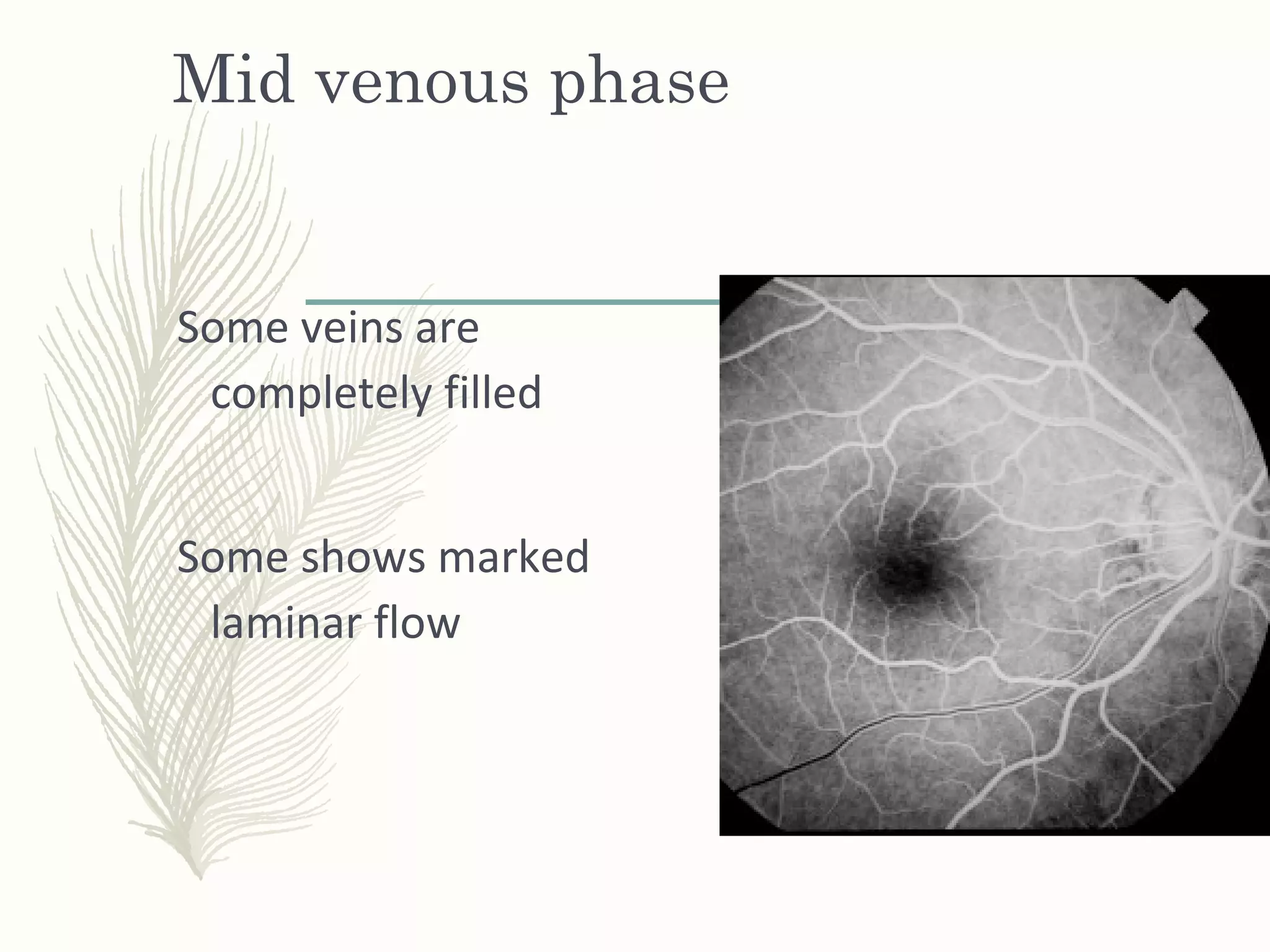 FUNDUS FLUORESCEIN ANGIOGRAPHY | PPT