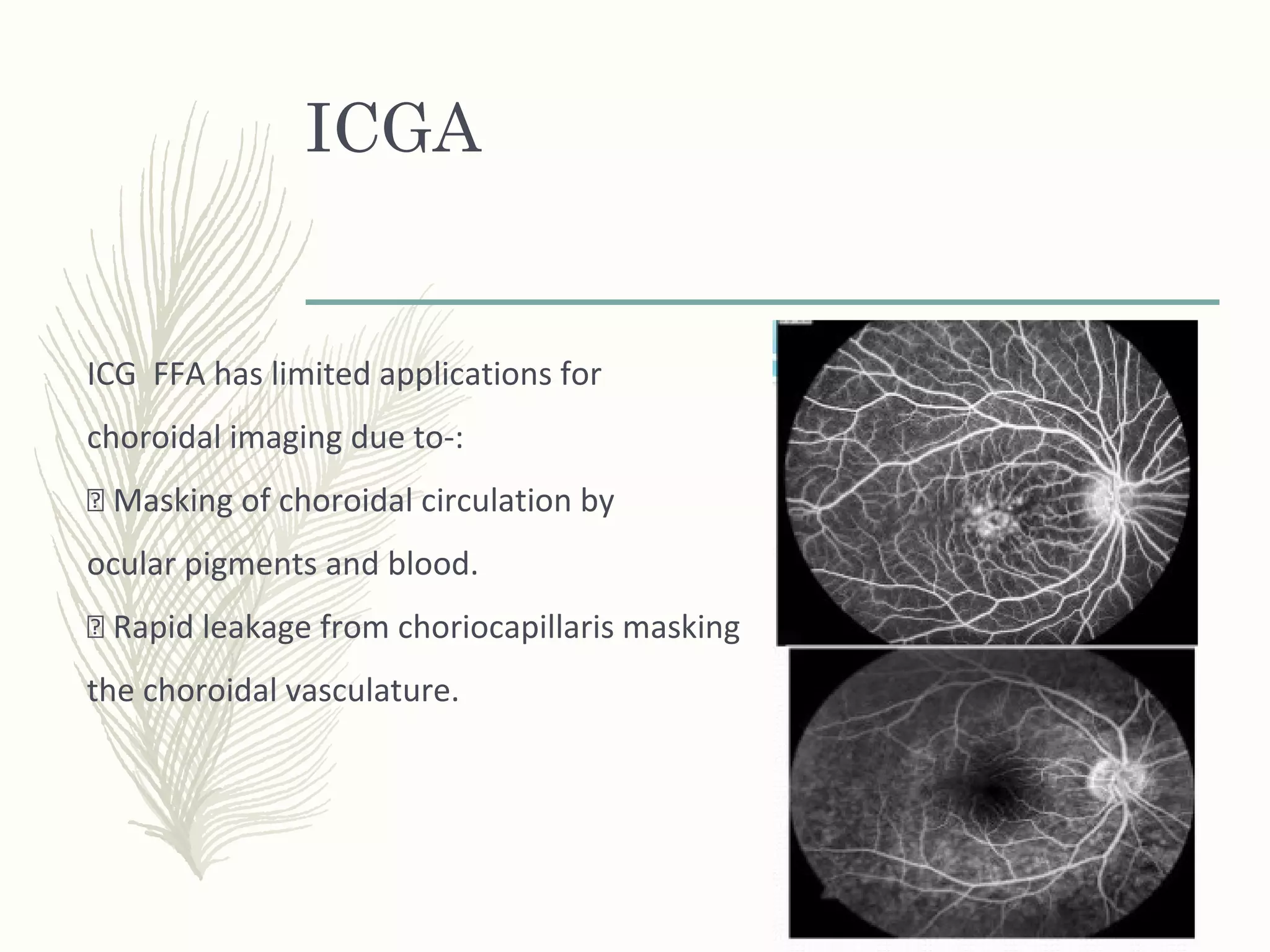 FUNDUS FLUORESCEIN ANGIOGRAPHY | PPT