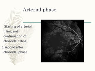 FUNDUS FLUORESCEIN ANGIOGRAPHY | PPT
