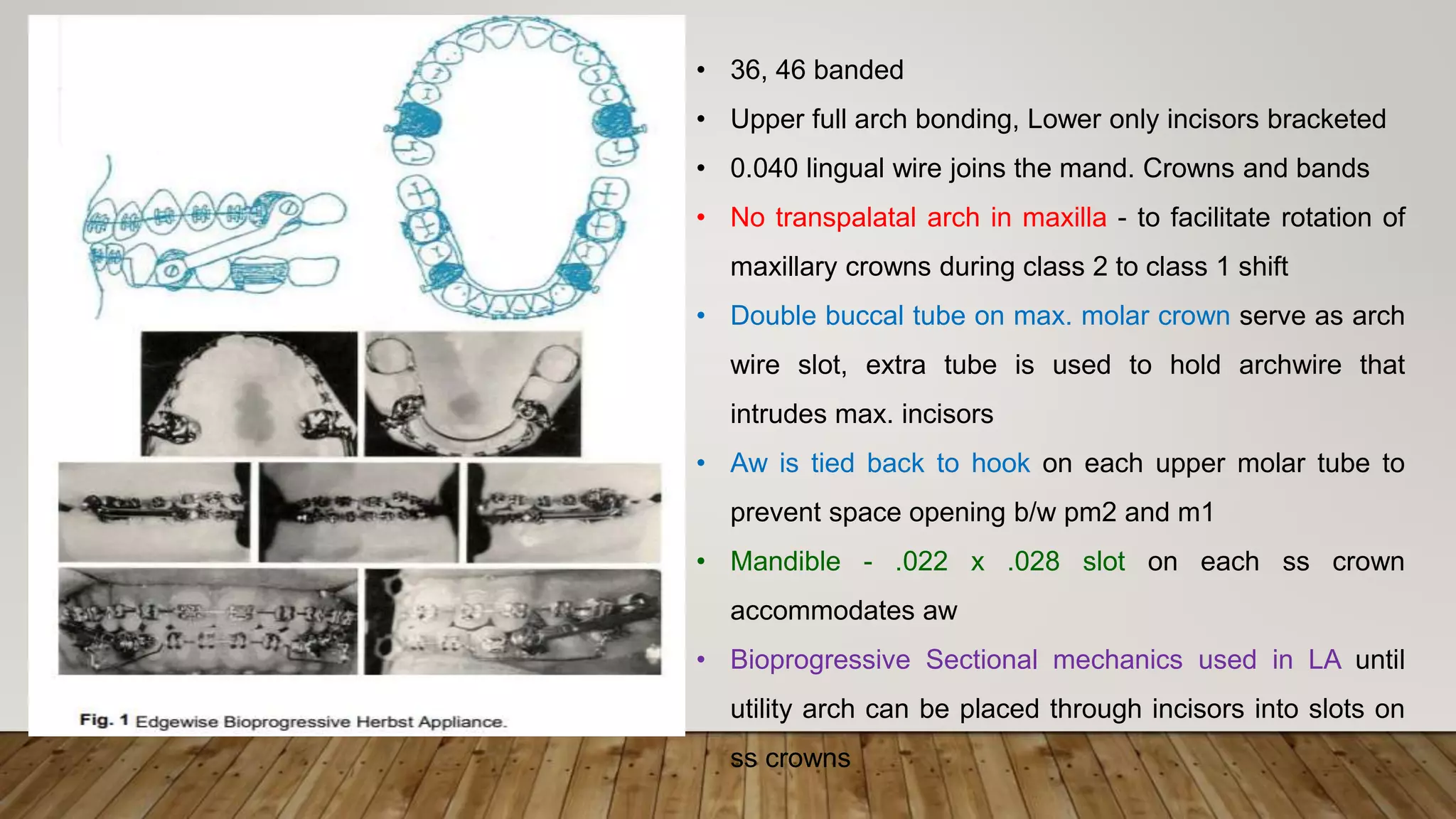 fixed functional appliances | PPTX