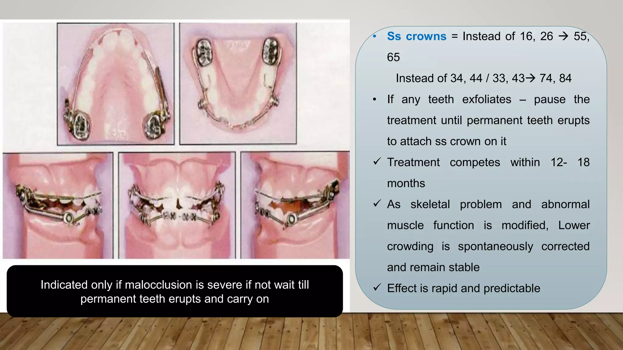 fixed functional appliances | PPTX