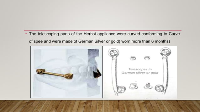 fixed functional appliances | PPTX