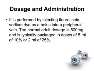 fundus flourescien angiography | PPT