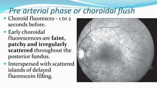 fundus fluorescein angiography V/S indocyanine green angiography | PPTX