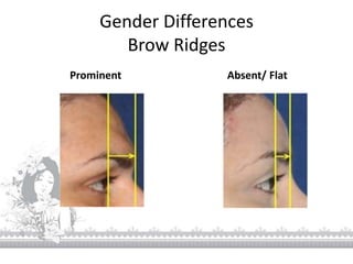 Olmec Trueshape Forehead Feminization surgery in Delhi India | PPTX