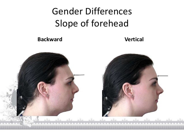 Olmec Trueshape Forehead Feminization surgery in Delhi India