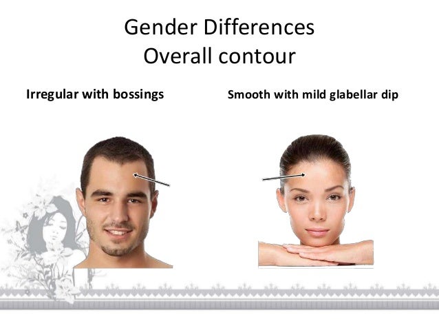 Olmec Trueshape Forehead Feminization surgery in Delhi India