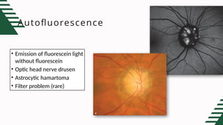 Pemeriksaan Fundus Fluorescein Angiography | PPTX
