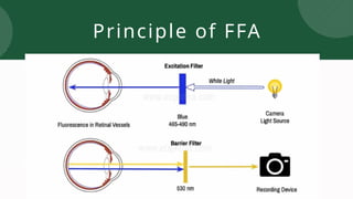 Pemeriksaan Fundus Fluorescein Angiography | PPTX